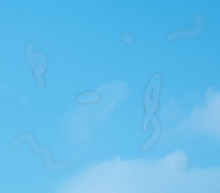 Eye Exercises for Floaters