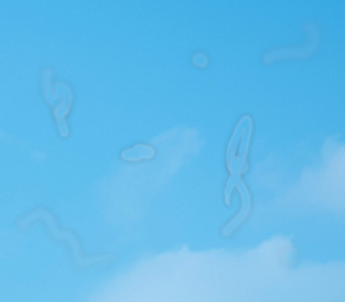 Eye Exercises for Floaters